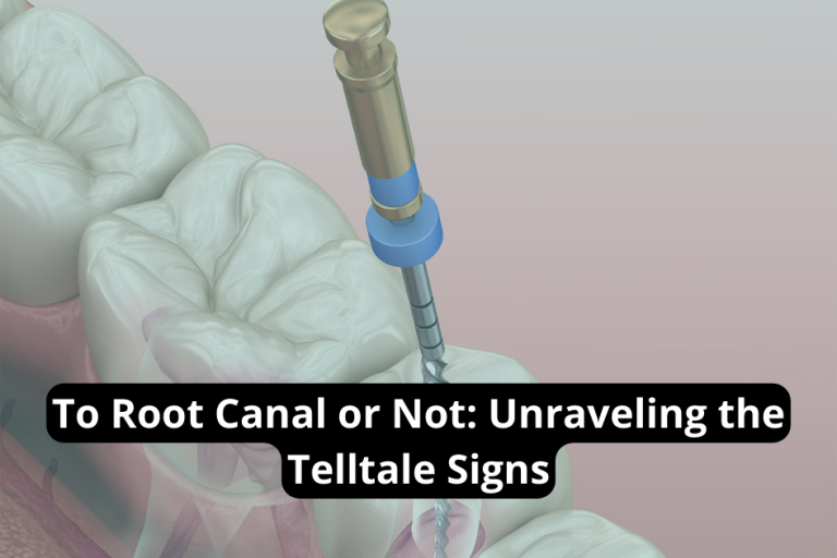 To Root Canal or Not: Unraveling the Telltale Signs | Austin Dental Works